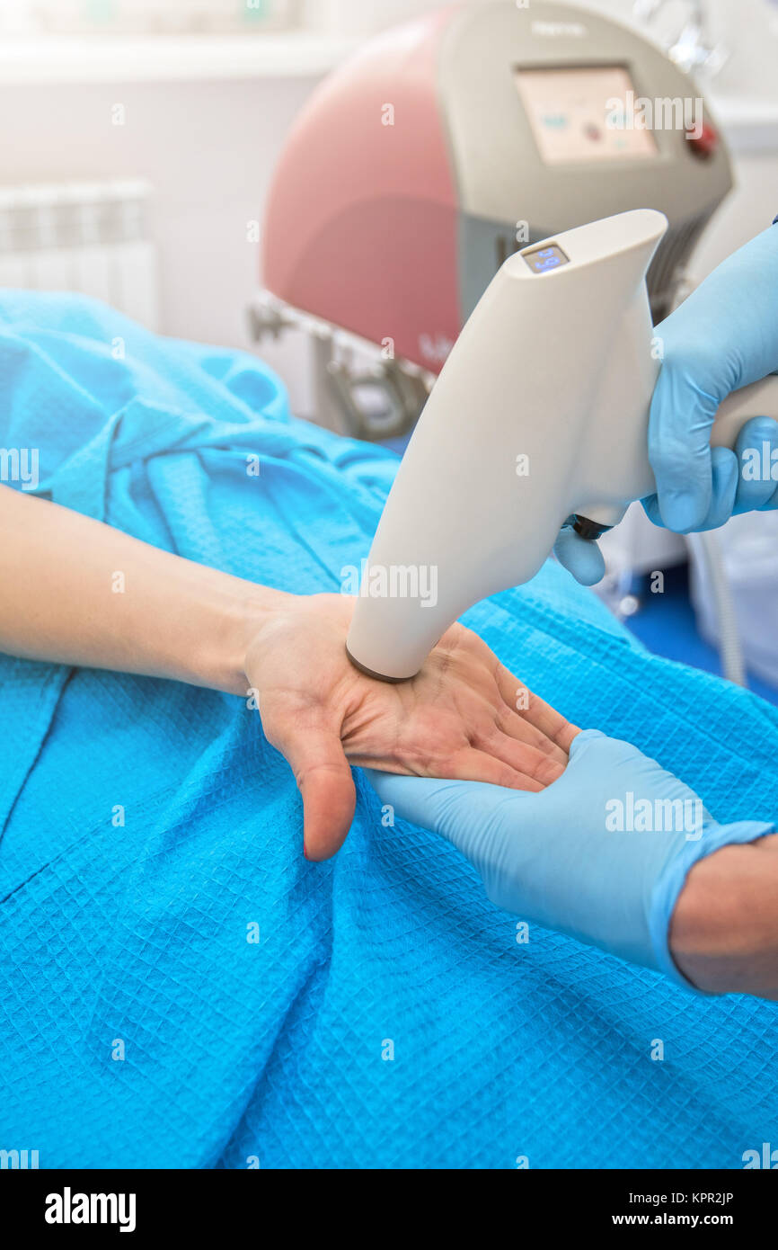 Procedure against hyperhidrosis Stock Photo - Alamy