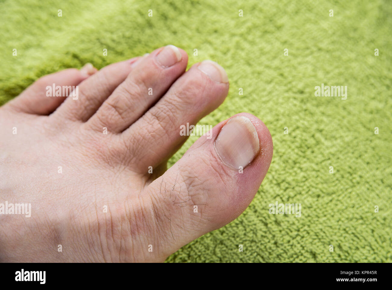 Stinky feet hi-res stock photography and images - Alamy