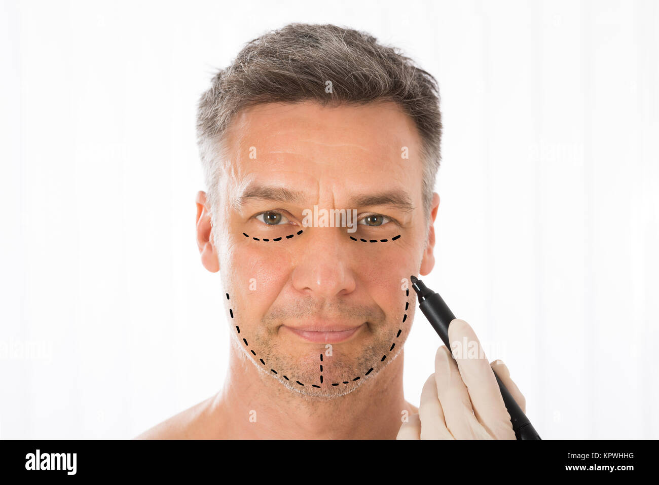 Surgeon Drawing Correction Lines On Man Face Stock Photo - Alamy