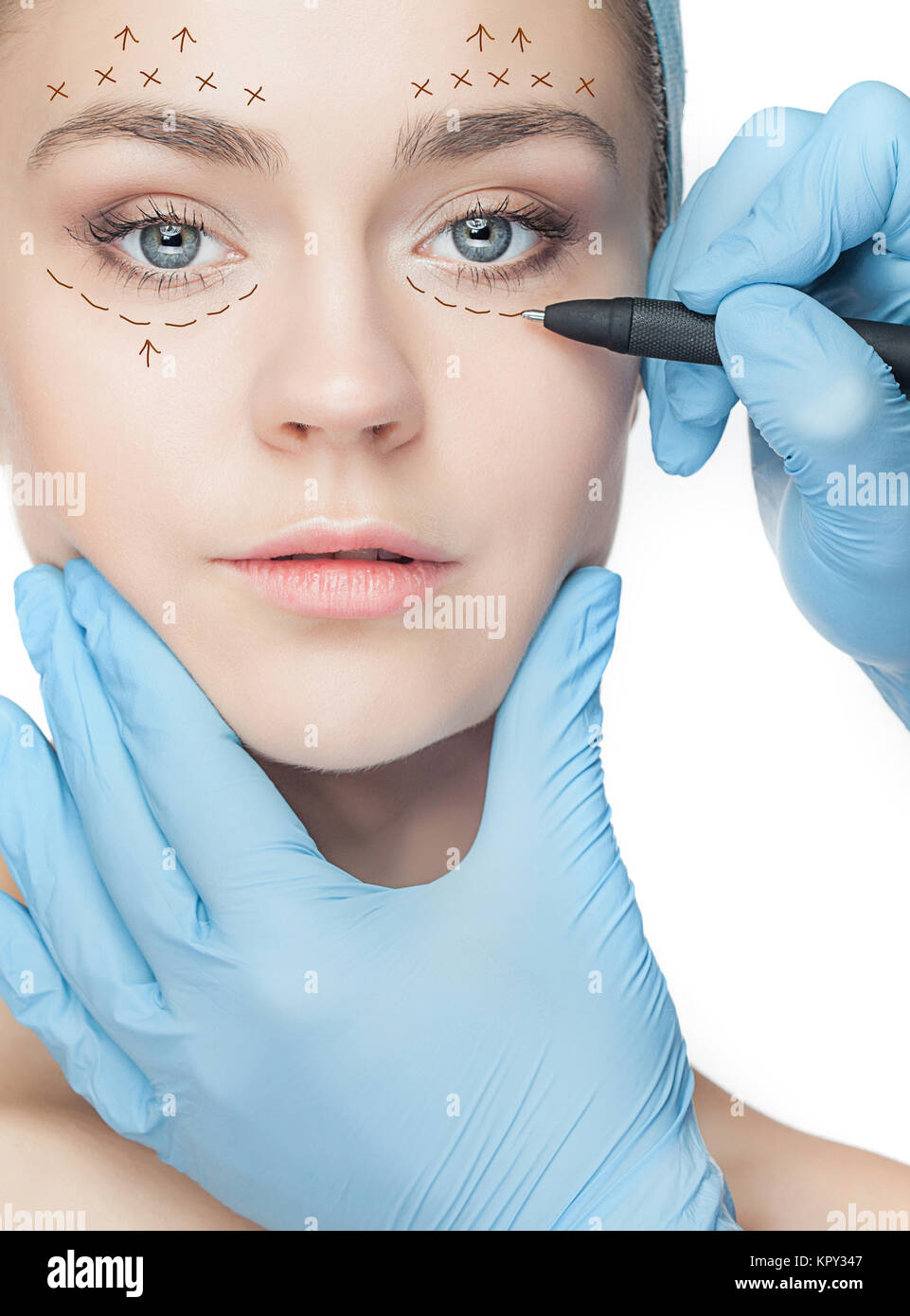 Beautiful young woman with perforation lines on her face before plastic ...