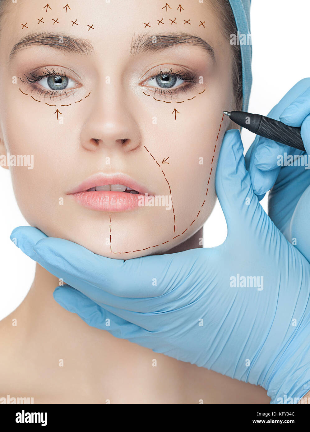 Beautiful young woman with perforation lines on her face before plastic ...