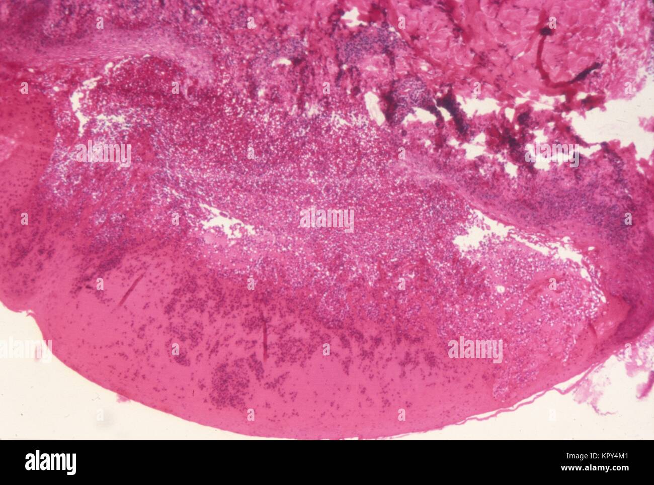 Hematoxylin eosin stain hi-res stock photography and images - Alamy
