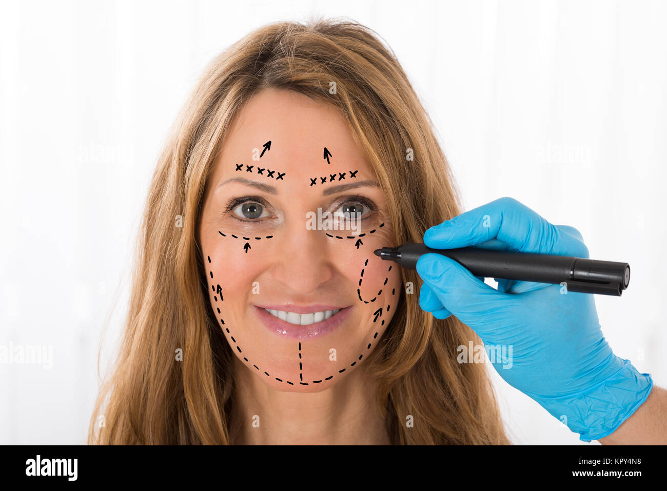 Woman With Perforation Lines Marked On Face Stock Photo - Alamy