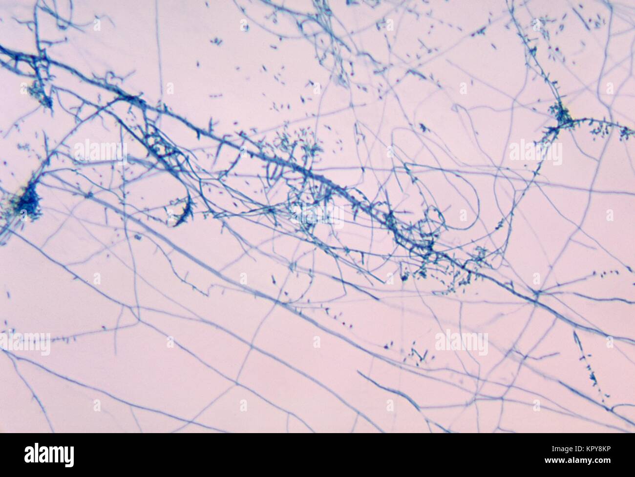 Photomicrograph of the zoophilic fungus Trichophyton mentagrophytes ...