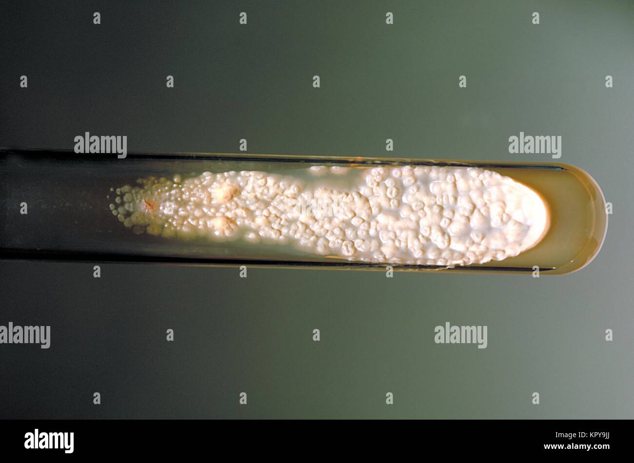 This is a SABHI agar slant culture of the fungus Sporothrix schenckii ...