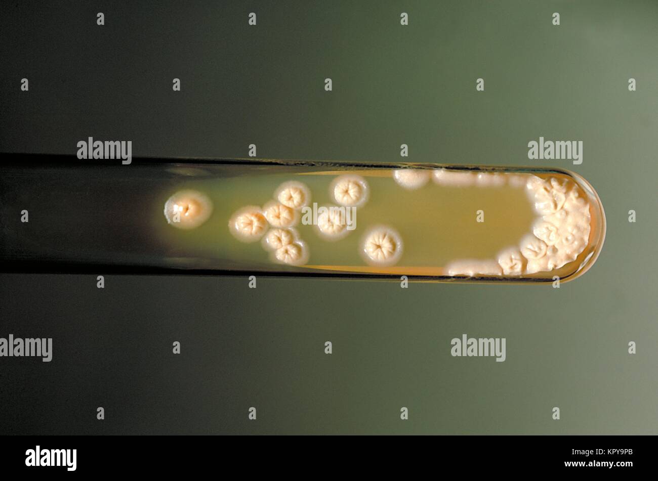 This is a SABHI agar slant culture of the fungus Sporothrix schenckii ...