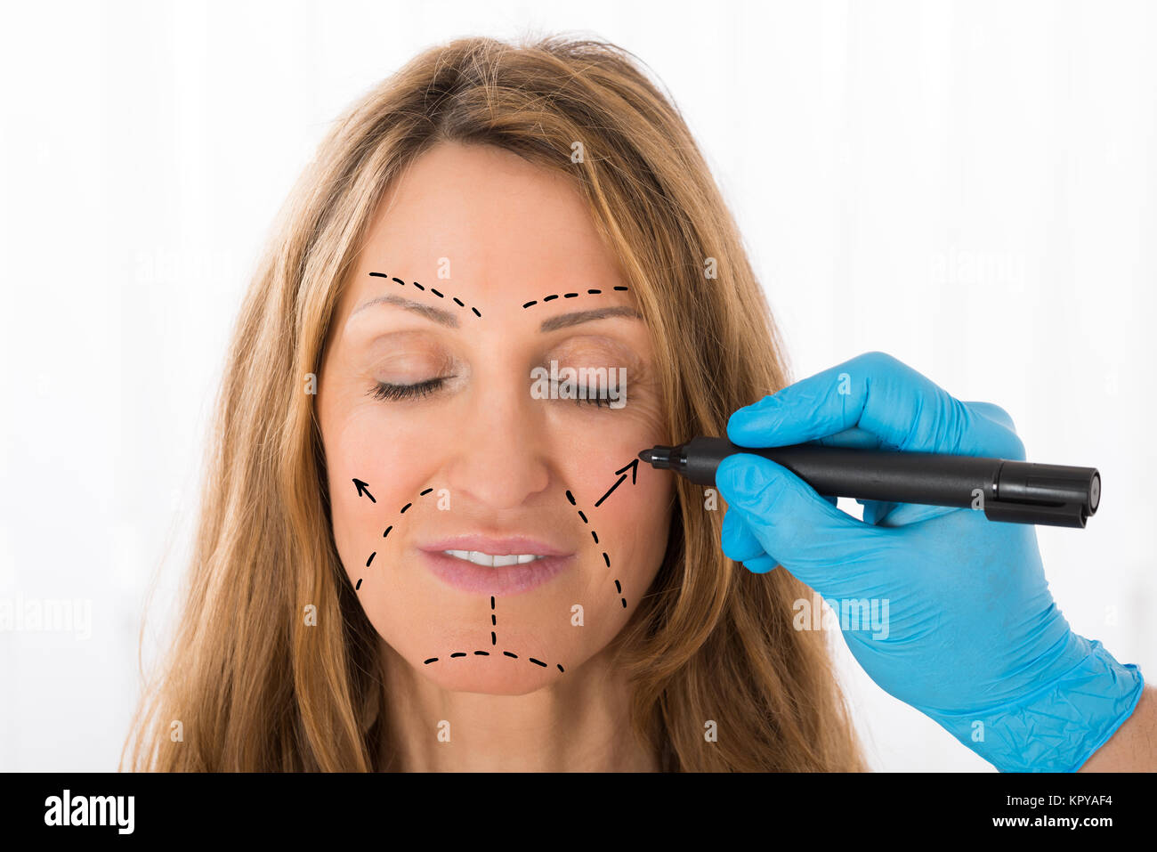 Surgeon Drawing Correction Lines On Woman Face Stock Photo - Alamy