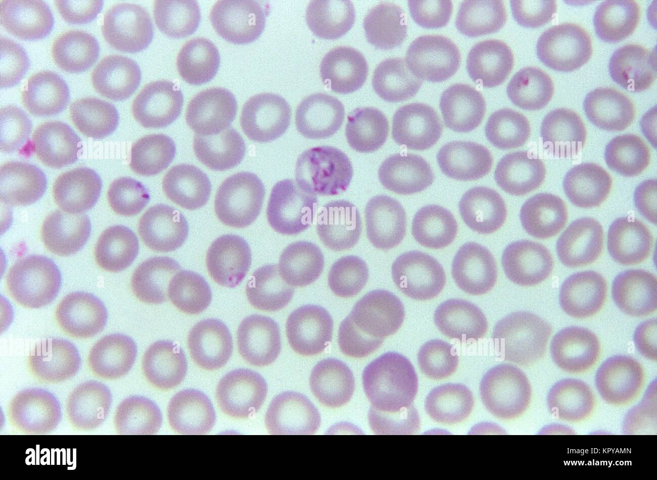 Babesia hi-res stock photography and images - Alamy