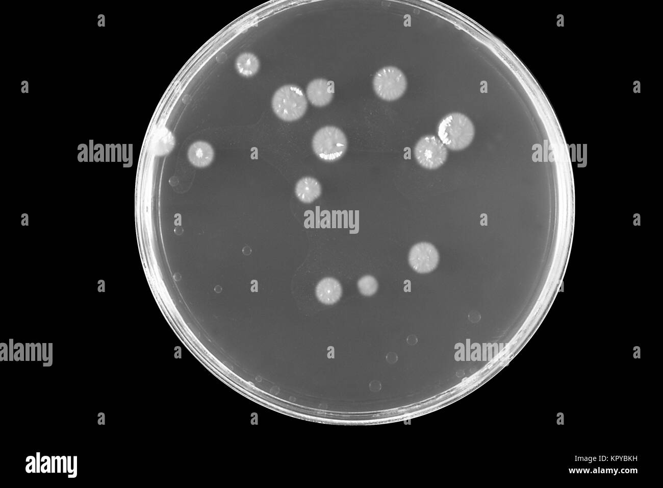 Pictured is a SABHI agar plate culture of the fungus Histoplasma Stock ...