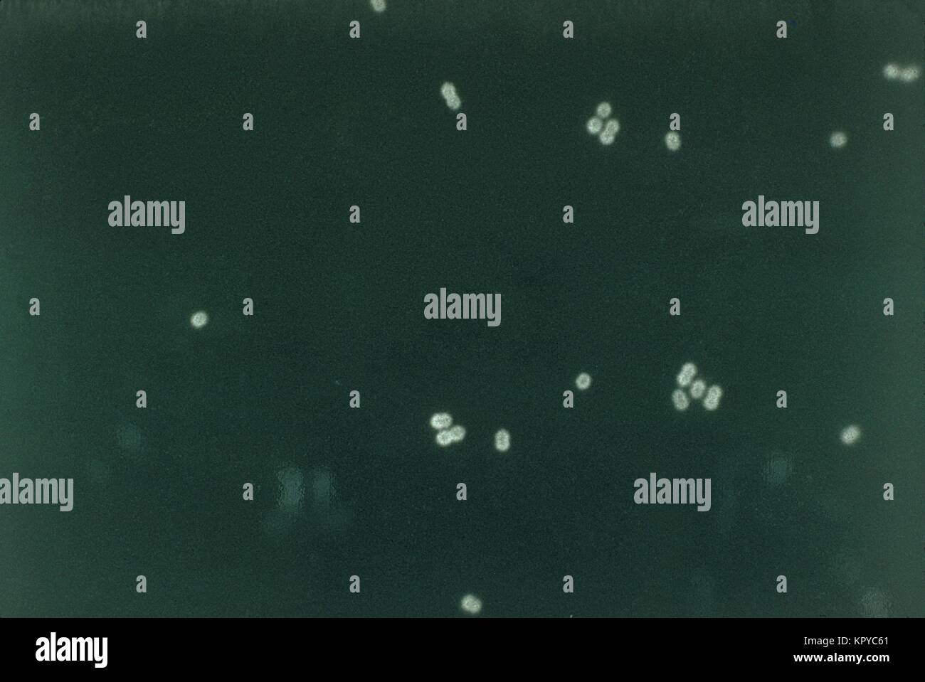 This micrograph depicts Streptococcus pneumoniae bacteria in cerebral ...