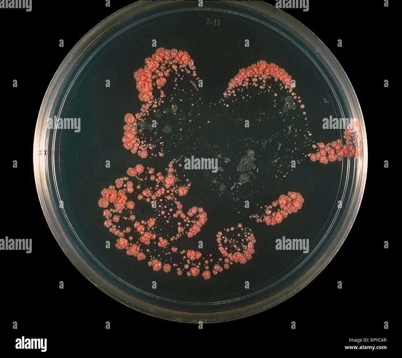 Nocardia bacteria hi-res stock photography and images - Alamy