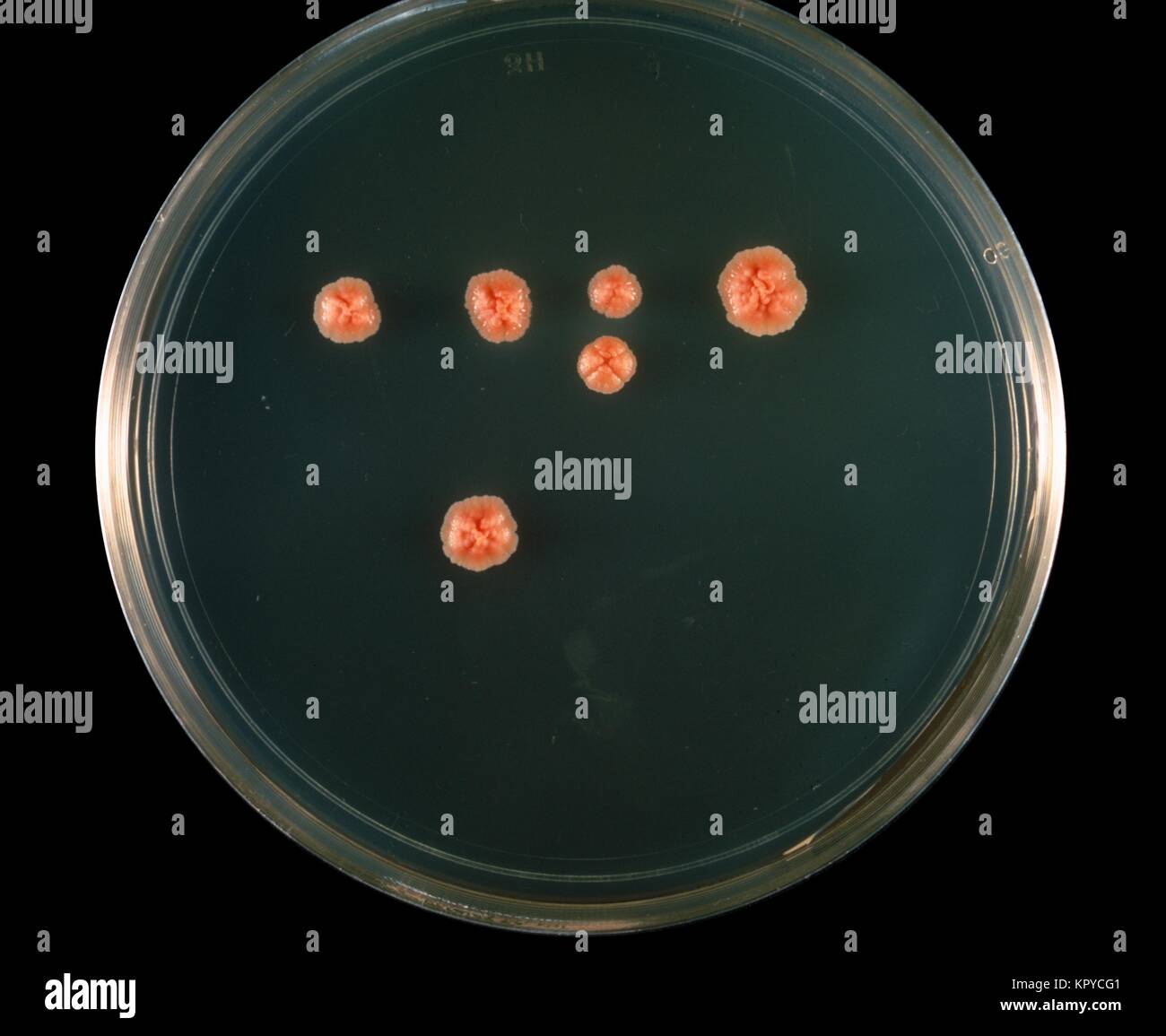 Nocardia Asteroides Section Of Nocardia Asteroides | Stock Image