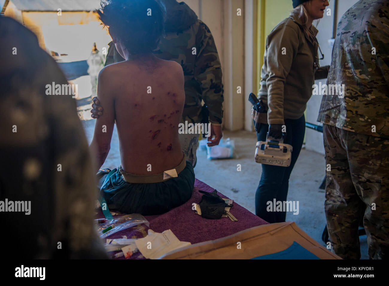An Afghan child receives treatment at a joint field medical treatment ...