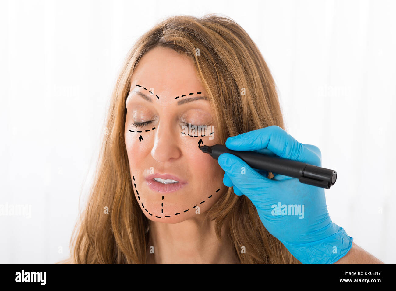 Facelift correction hi-res stock photography and images - Alamy