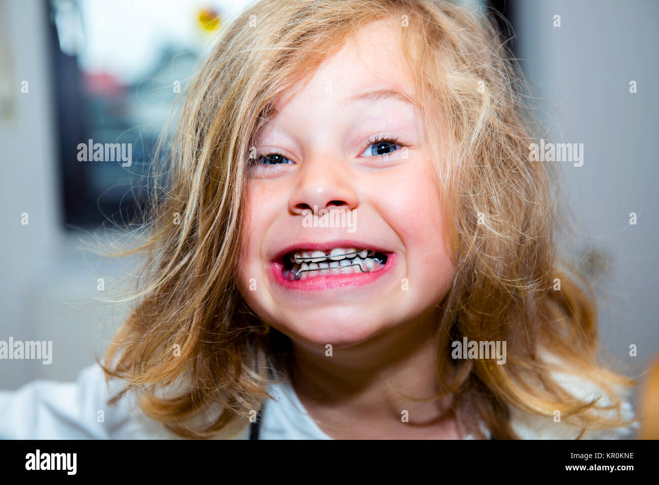 little funny girl with retainer looking in to the camera Stock Photo ...