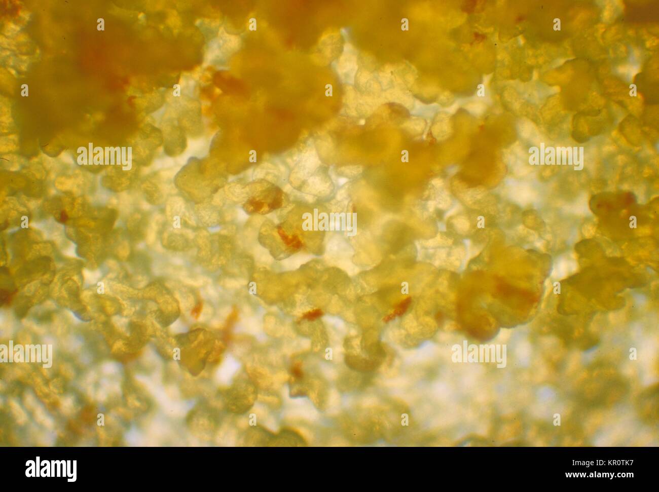 Mycobacterium marinum skin infection hi-res stock photography and ...