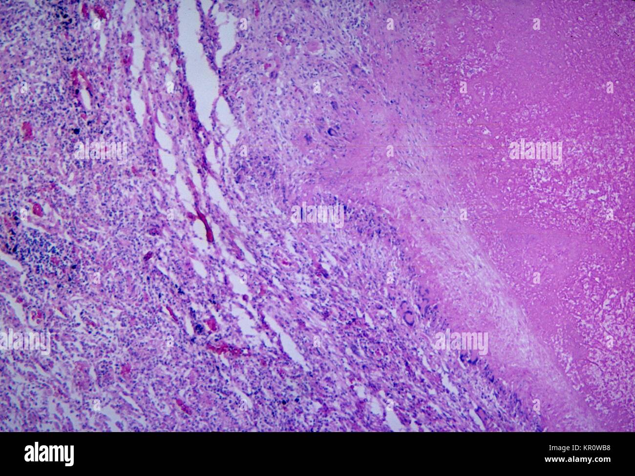 Zygomycetes hi-res stock photography and images - Alamy