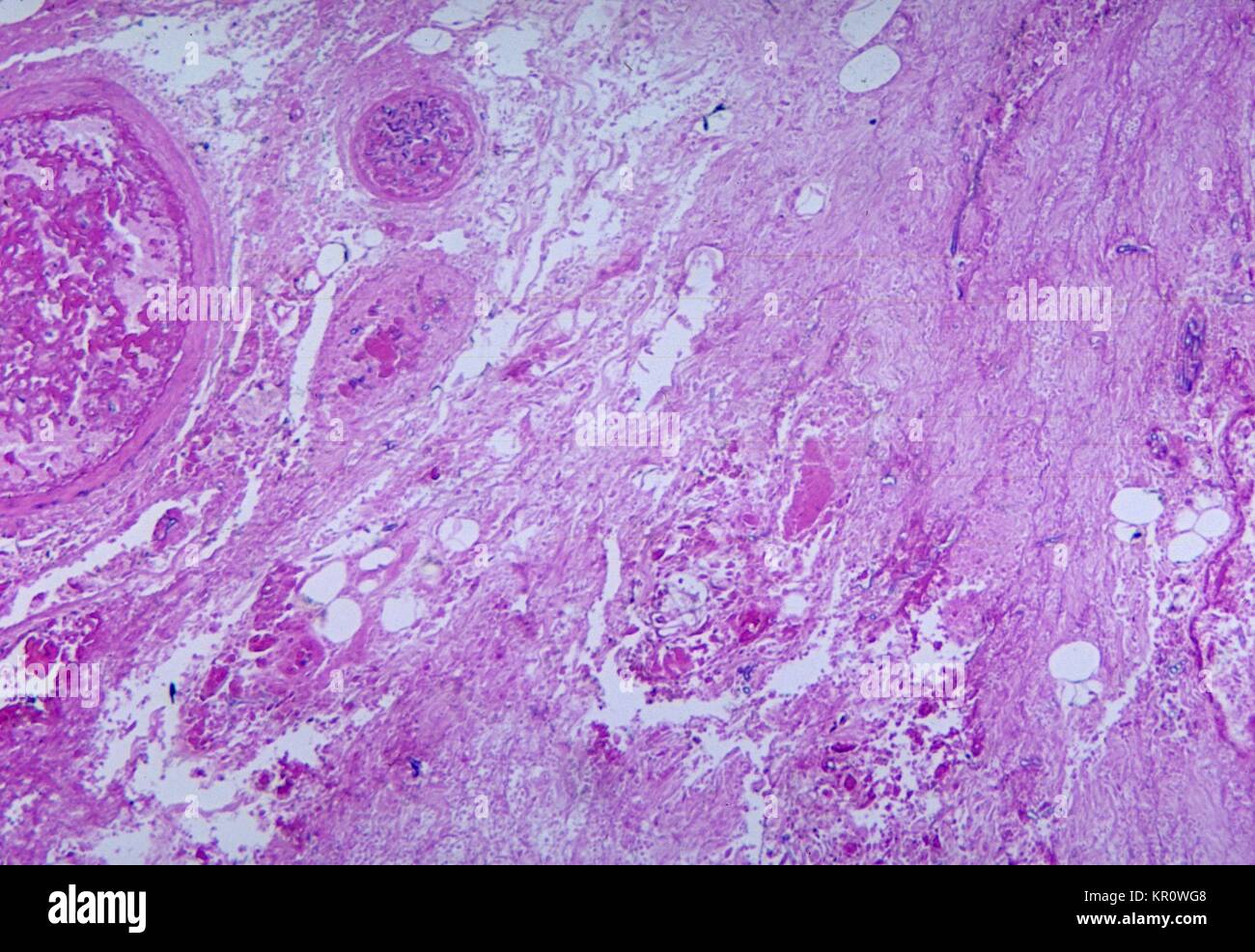 Zygomycetes hi-res stock photography and images - Alamy