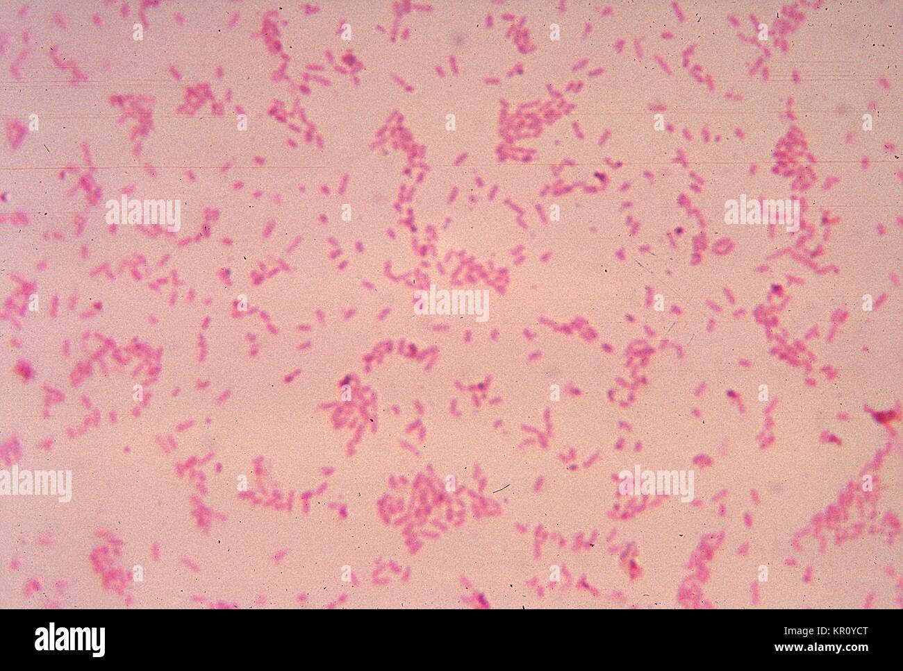 This micrograph depicts Bacteroides fragilis ss, 1972. ovatus bacteria ...