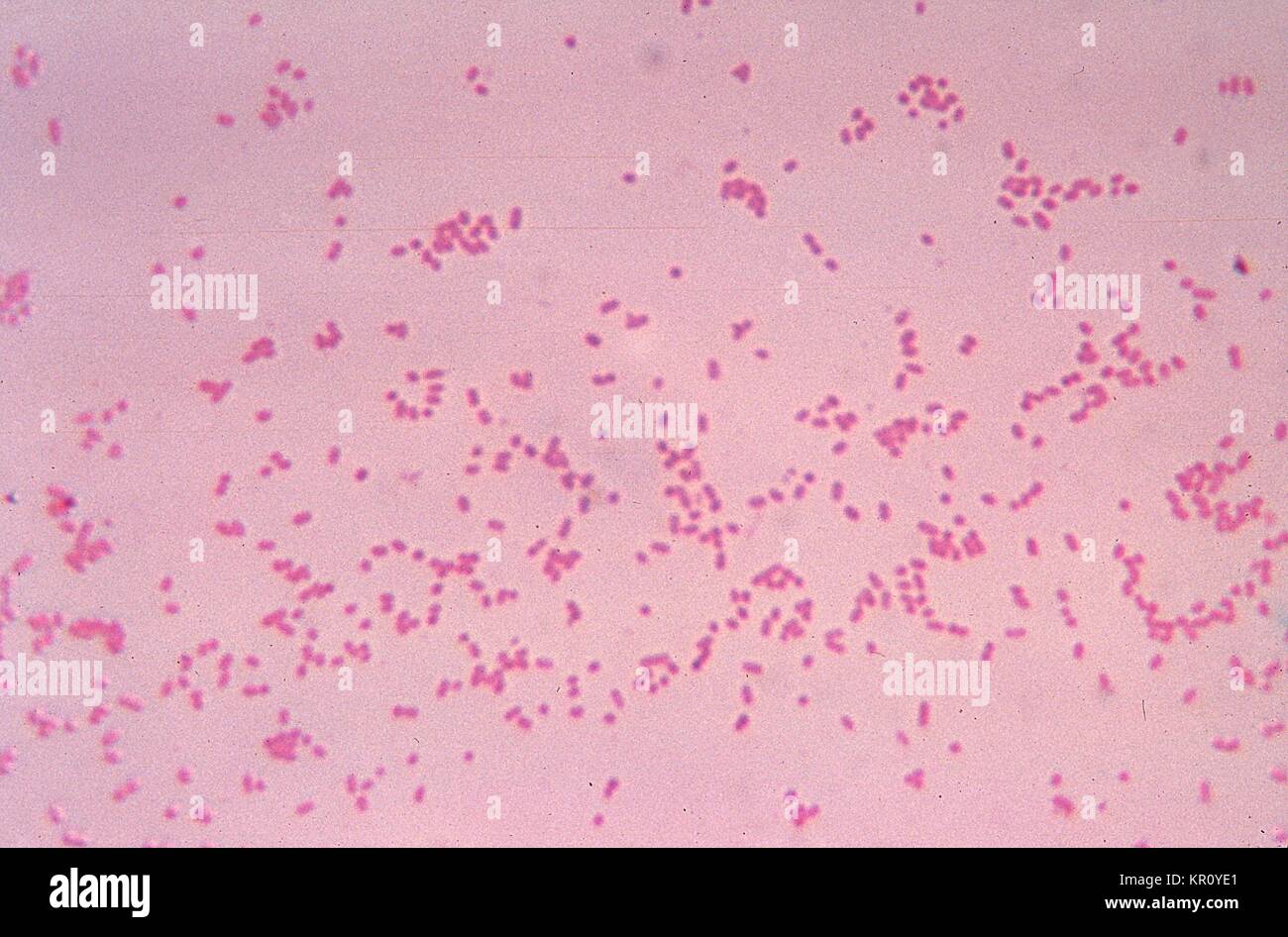 This micrograph depicts Bacteroides fragilis subsp, 1972. distasonis ...