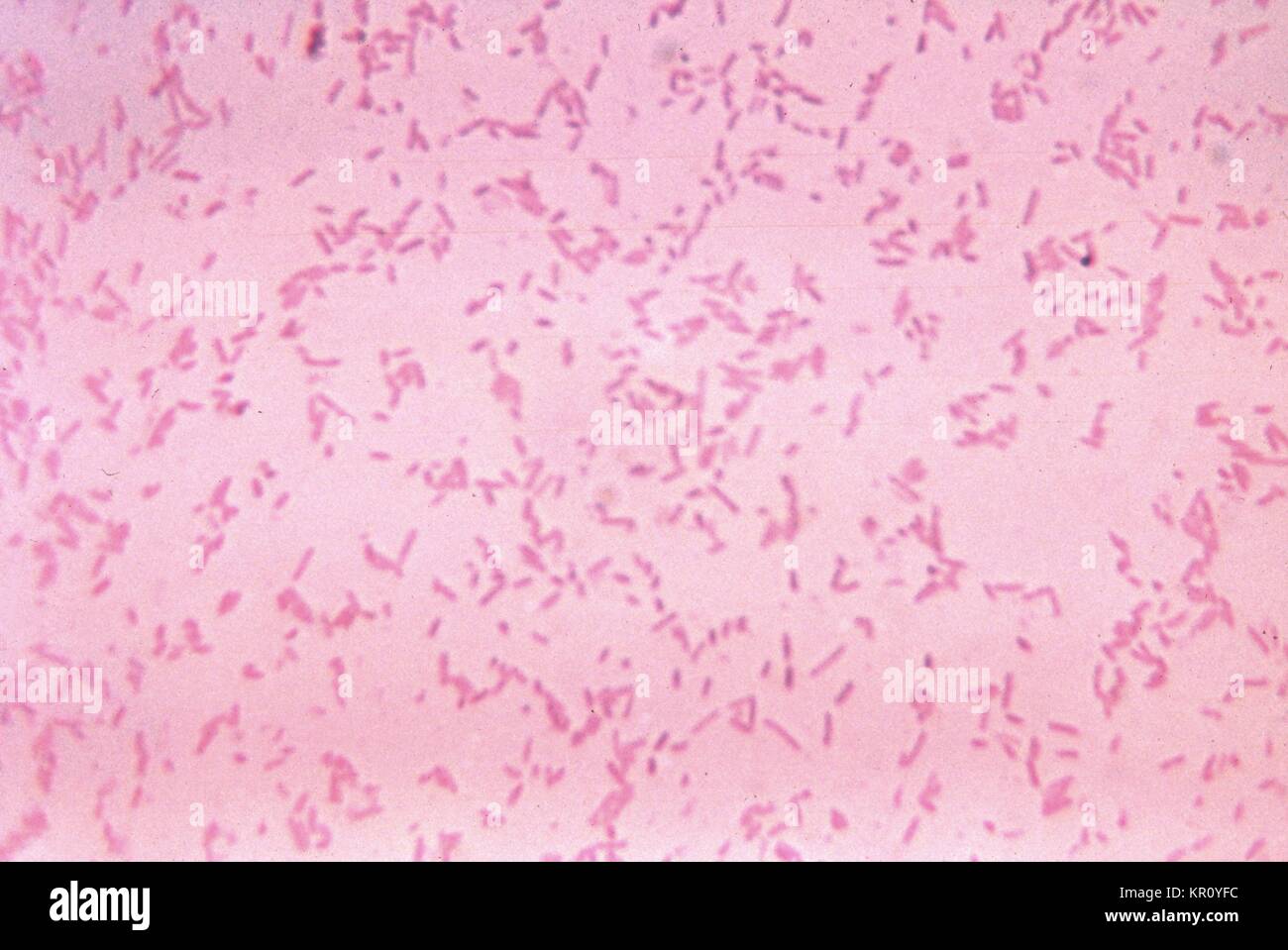 Bacteroides hi-res stock photography and images - Alamy