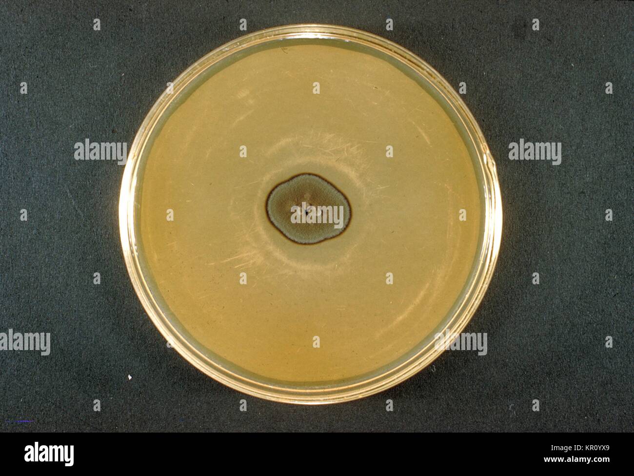 Shown here is a plate culture of Cladosporium carrionii, at four weeks ...