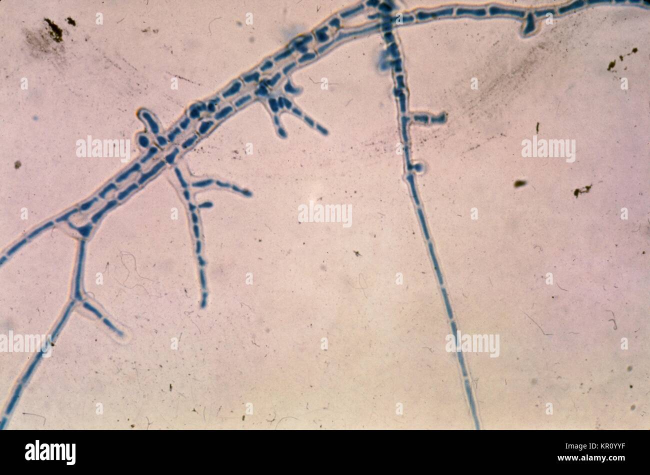 This is a photomicrograph of the mycelium of the fungus Piedraia hortae ...