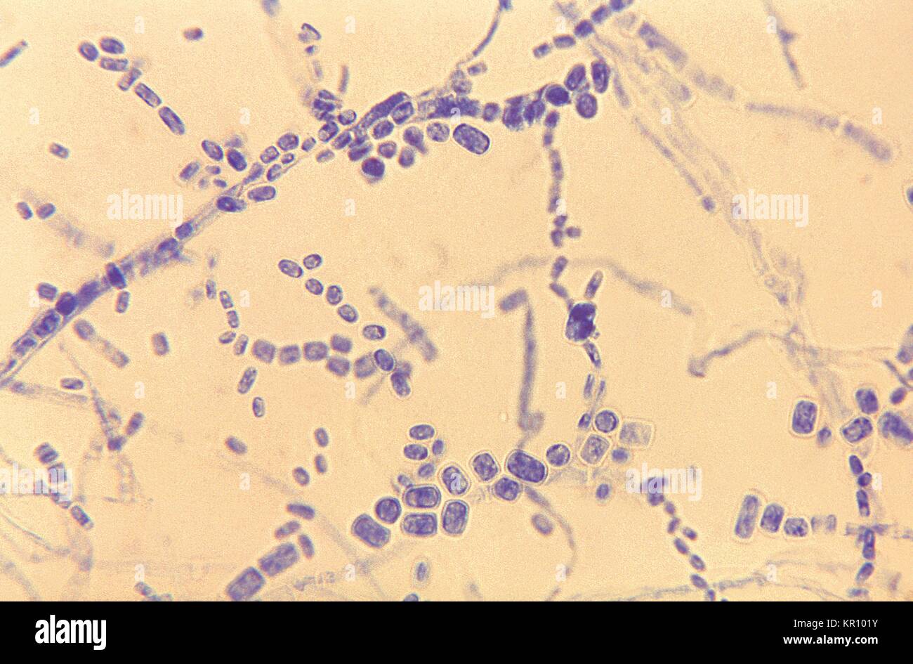 Geotrichum hi-res stock photography and images - Alamy