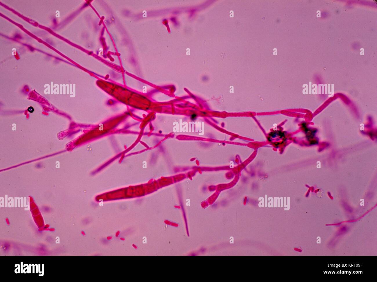 Microconidia hi-res stock photography and images - Alamy