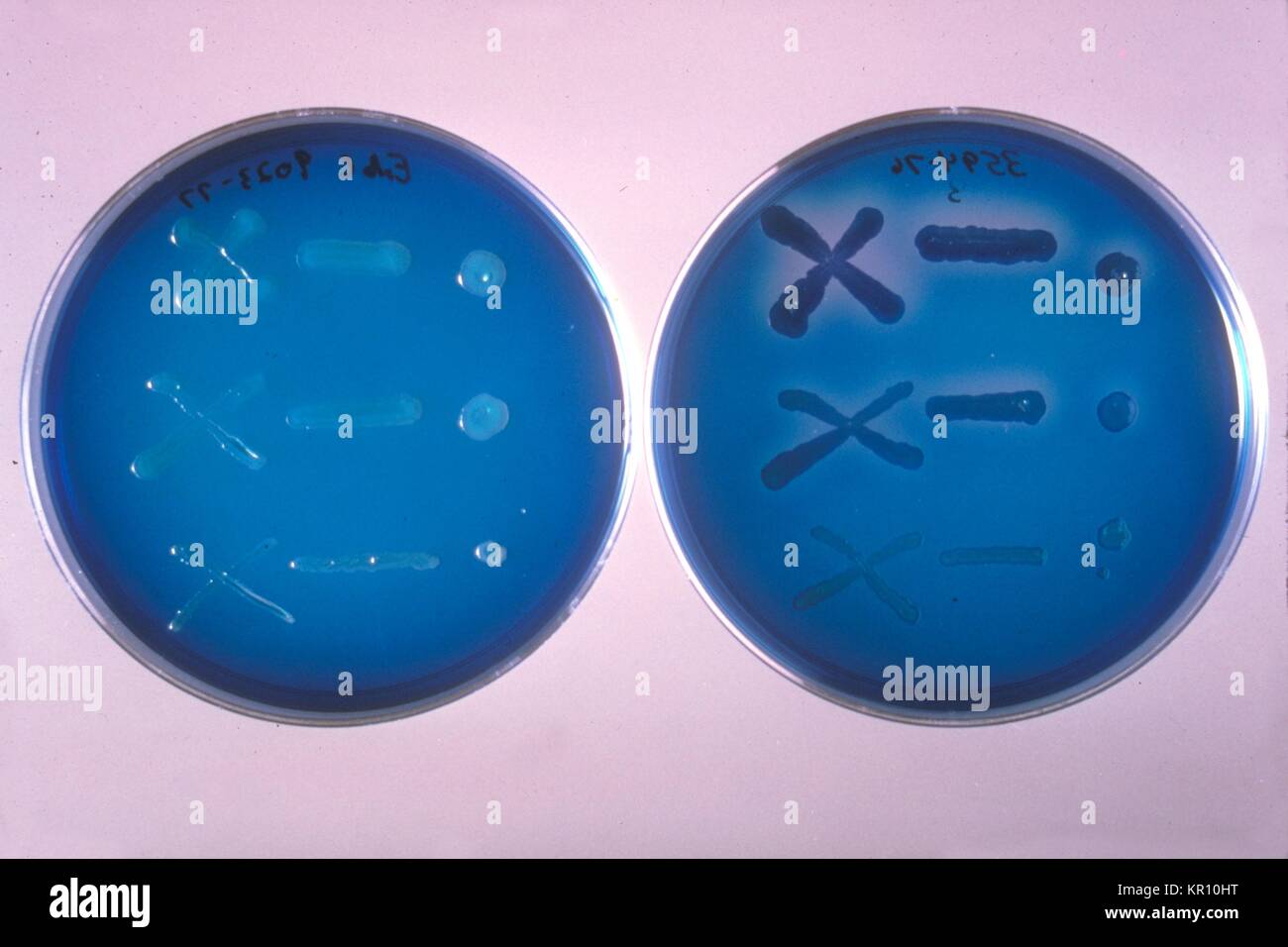 Enterobacter cloacae hi-res stock photography and images - Alamy