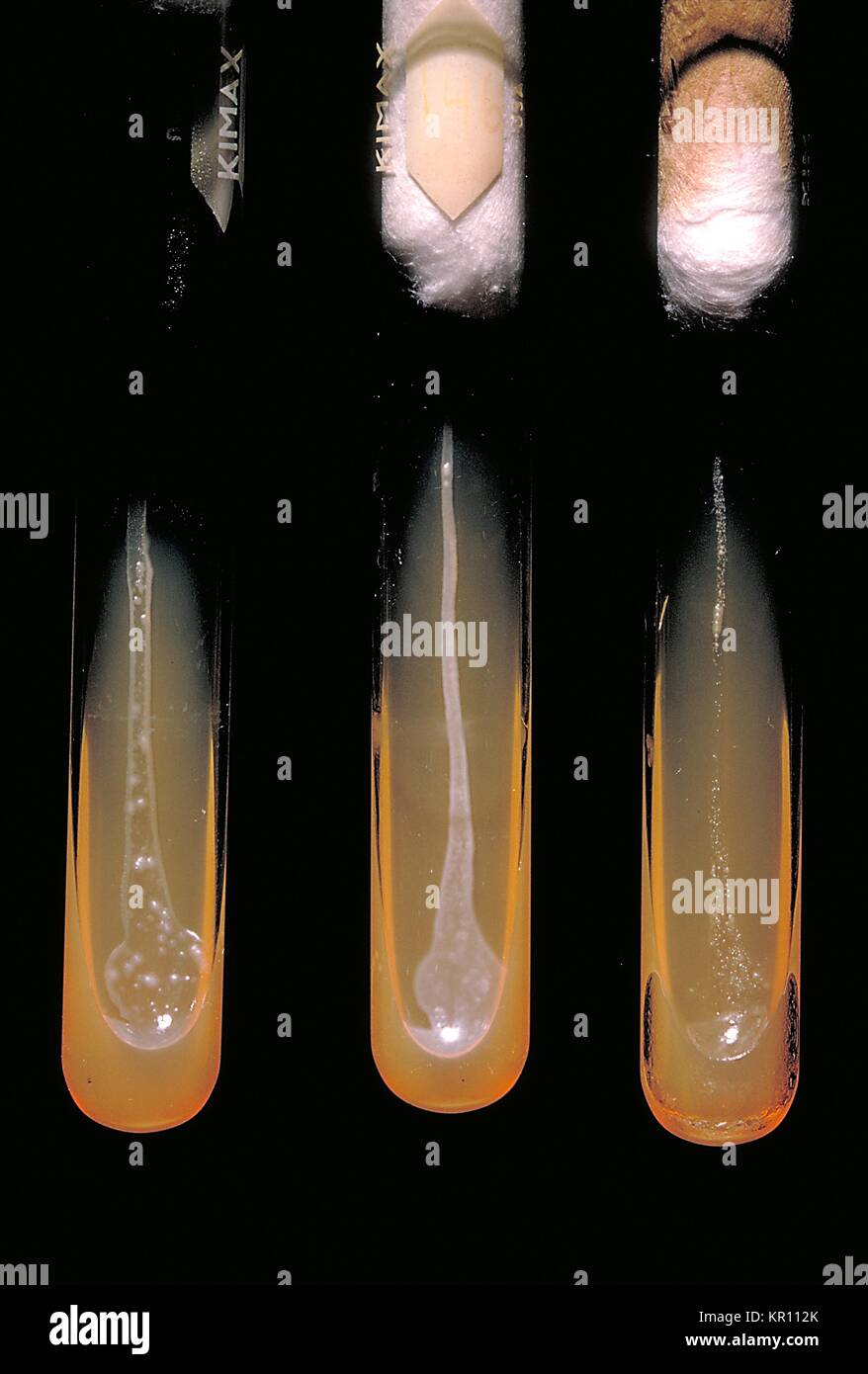 These slant cultures growing Actinomyces viscosus, reveal the oxygen ...