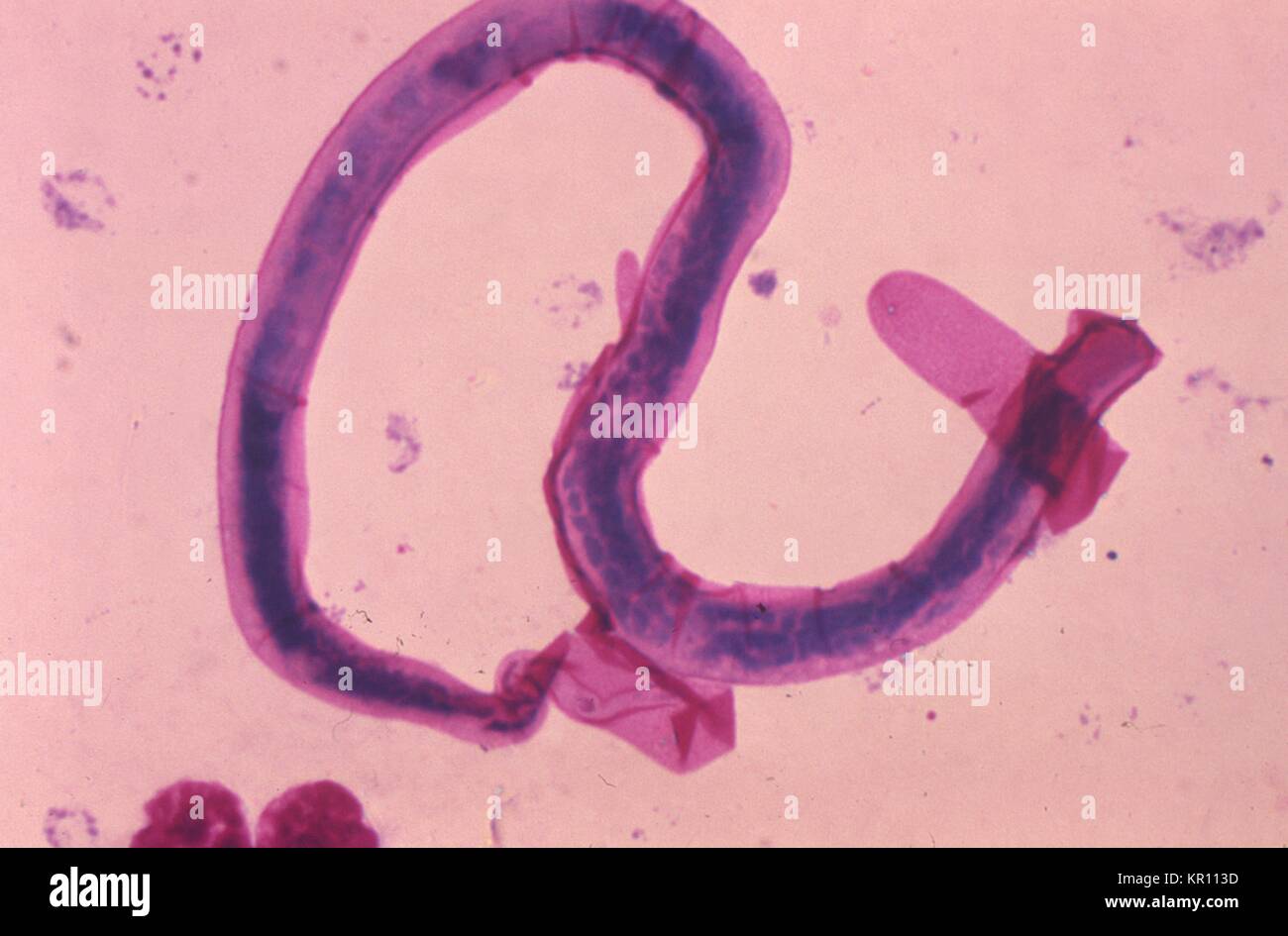 Microfilarial staged nematodal parasite hi-res stock photography and ...