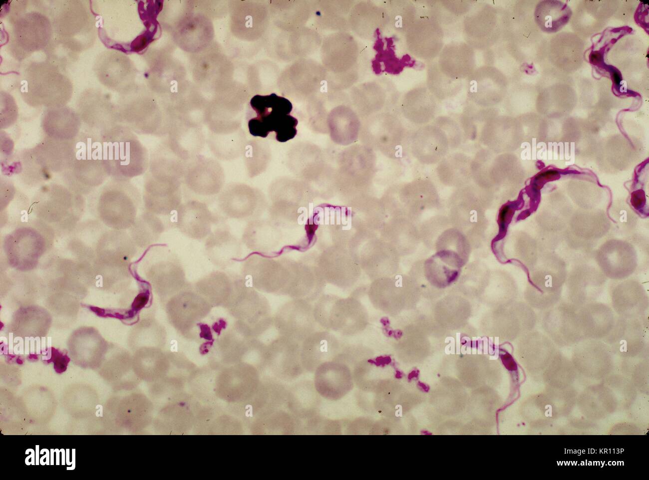 Rat blood smear hi-res stock photography and images - Alamy
