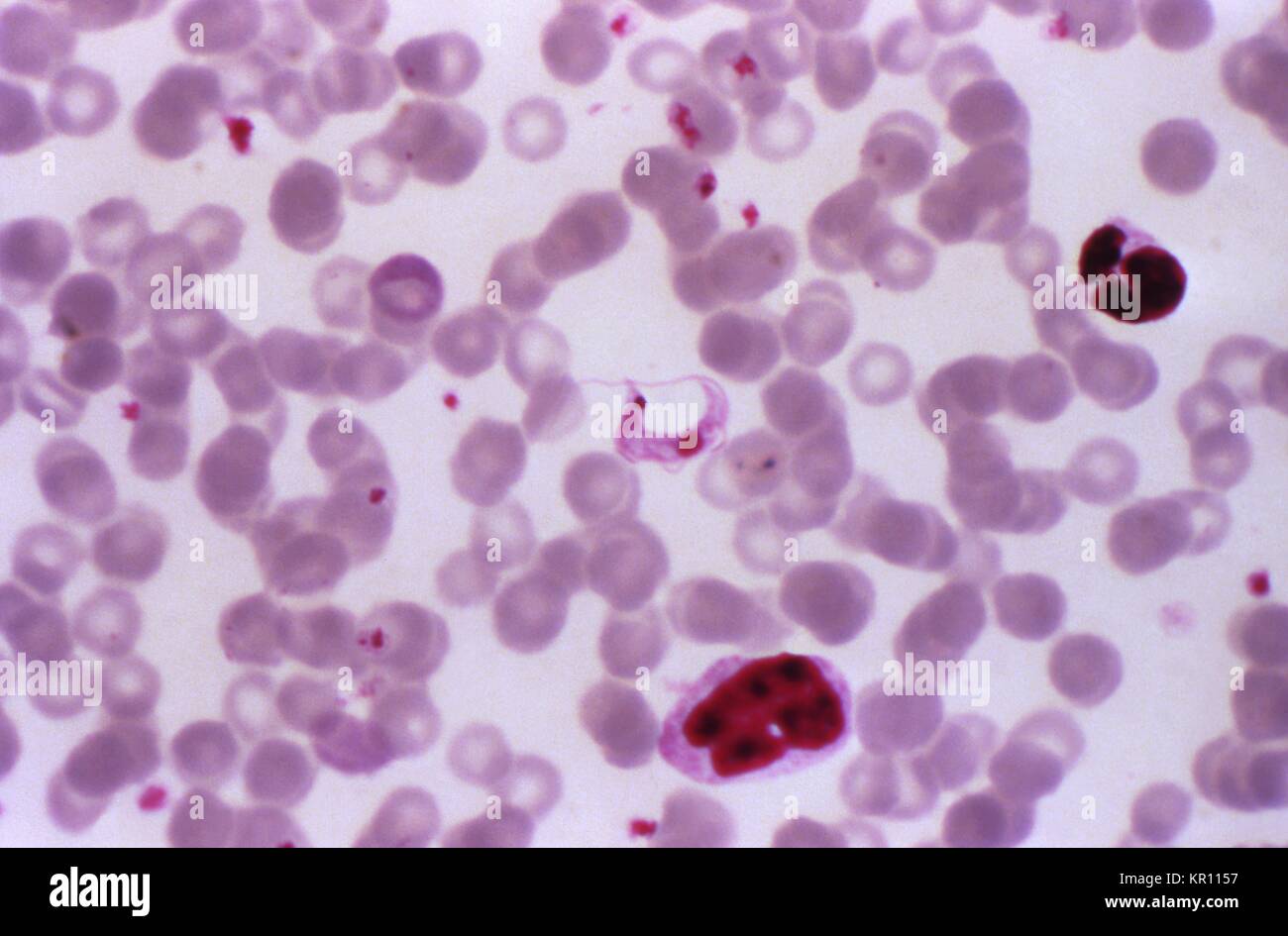 Trypanosoma cruzi parasites hi-res stock photography and images - Alamy