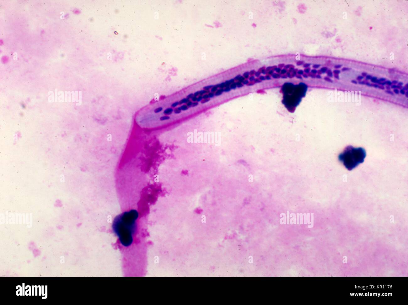 Ciclo Di Vita Della Wuchereria Bancrofti