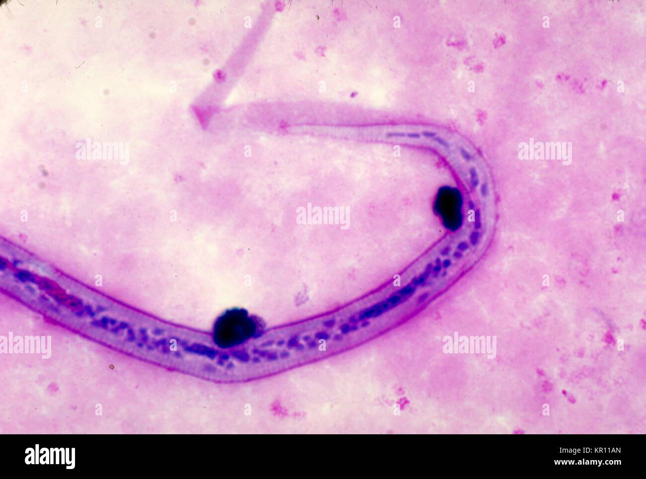 Nematoda Wuchereria