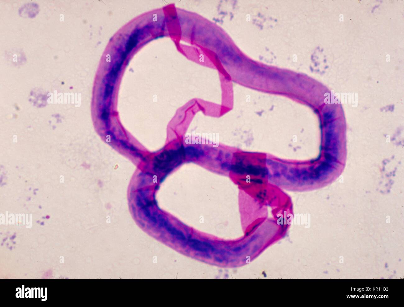 Microfilaria hi-res stock photography and images - Alamy