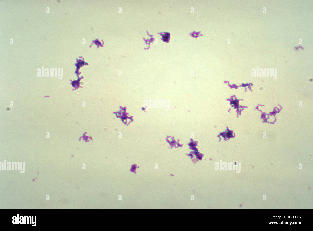 Peptostreptococcus spp hi-res stock photography and images - Alamy