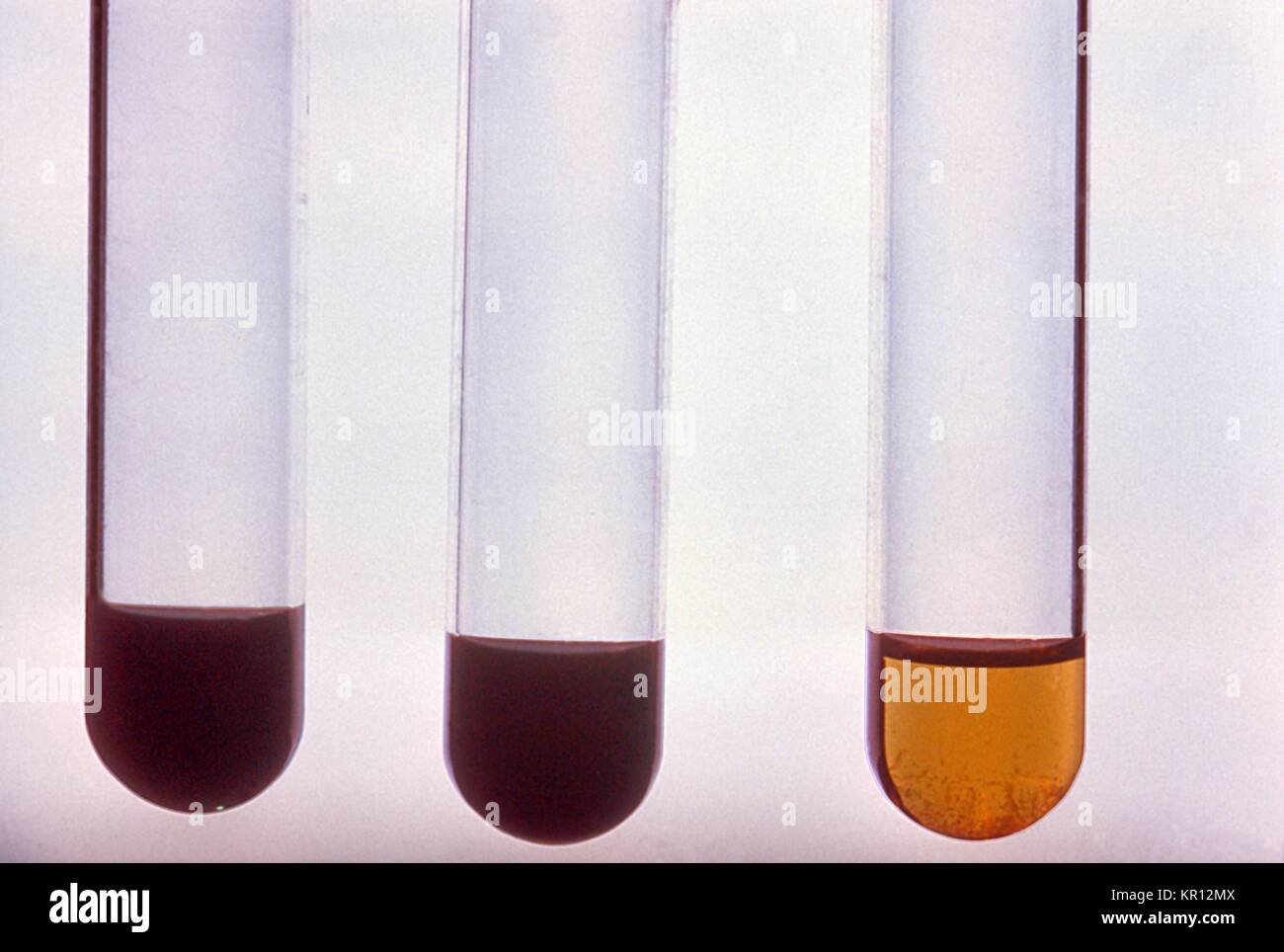 Cases of nocardiosis show hi-res stock photography and images - Alamy