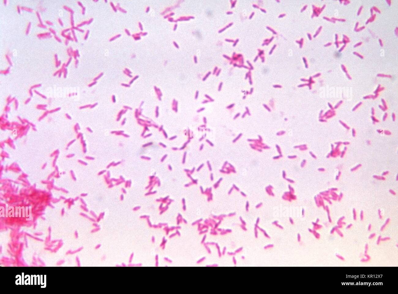 Pseudomonas Putida Gram Stain