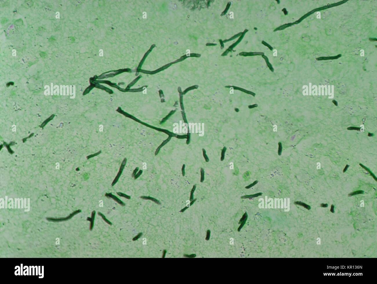 A micrograph of a pigeon brain using methenamine silver stain ...