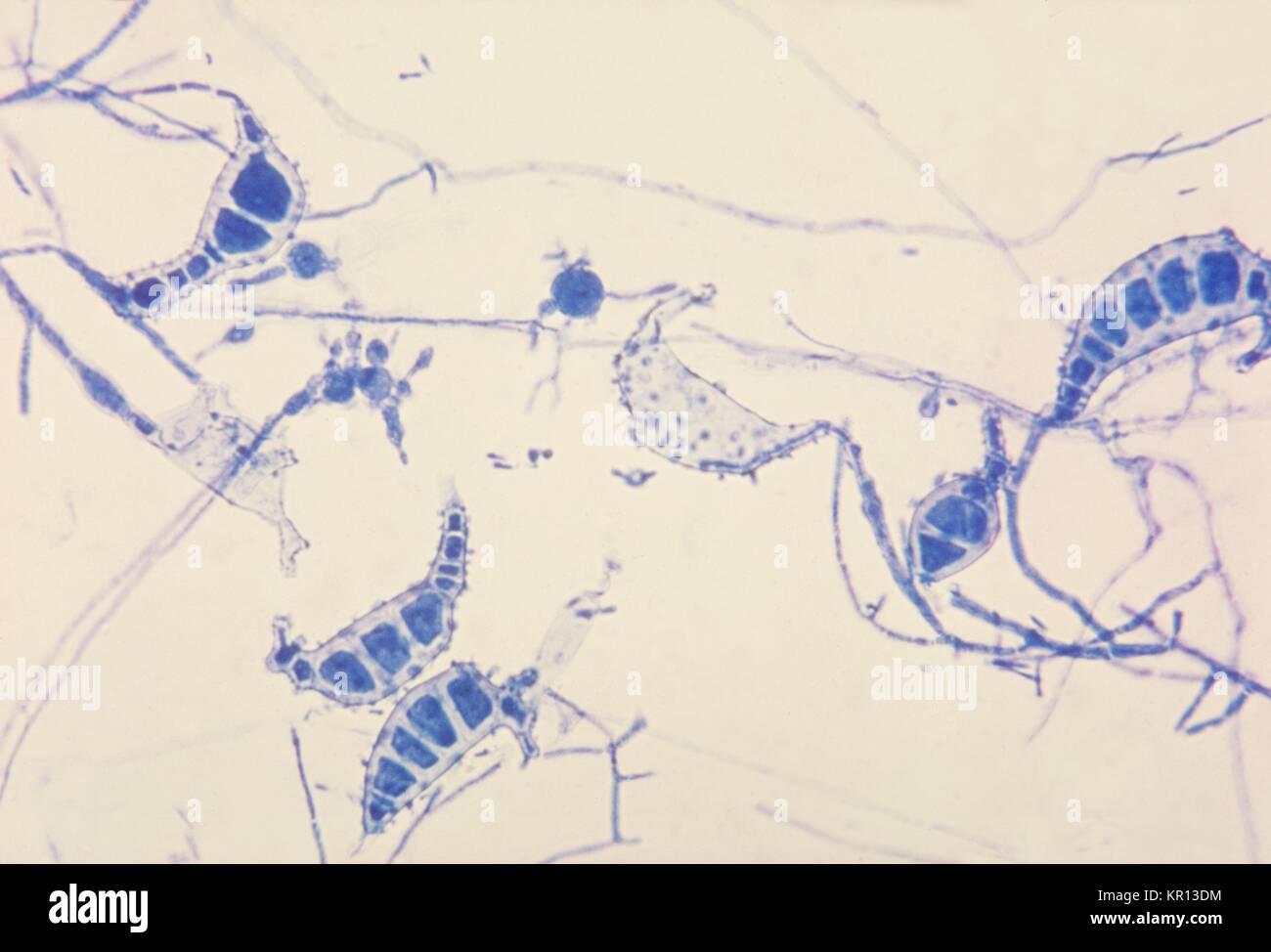 This is a photomicrograph of macroconidia, or large leaf or club-shaped ...
