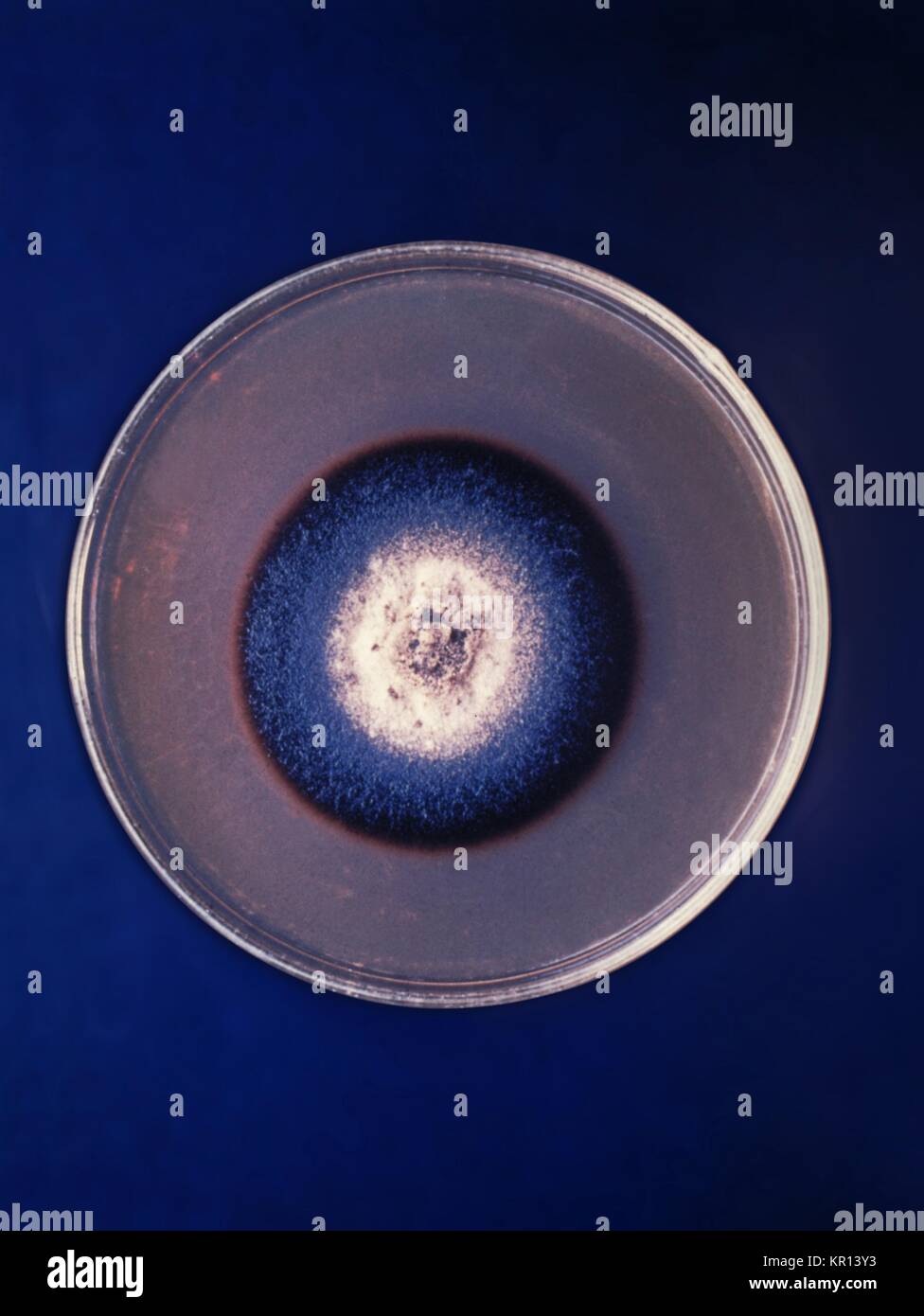 Piedraia Hortae Microscopic Morphology