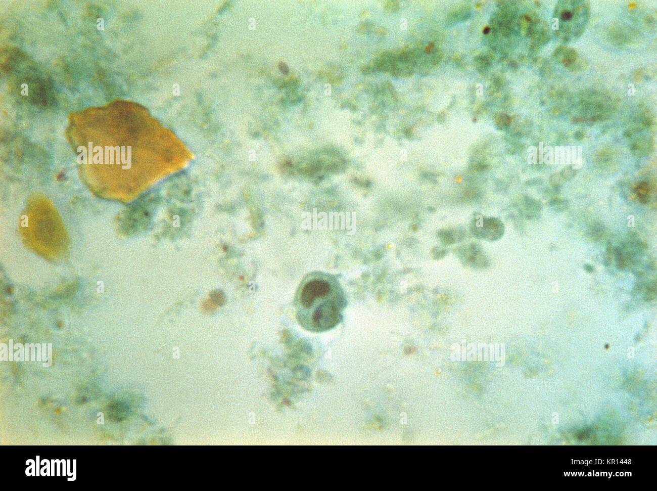 Parasite entamoeba polecki hi-res stock photography and images - Alamy