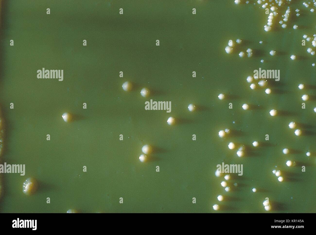 Mycobacterium Tuberculosis Culture