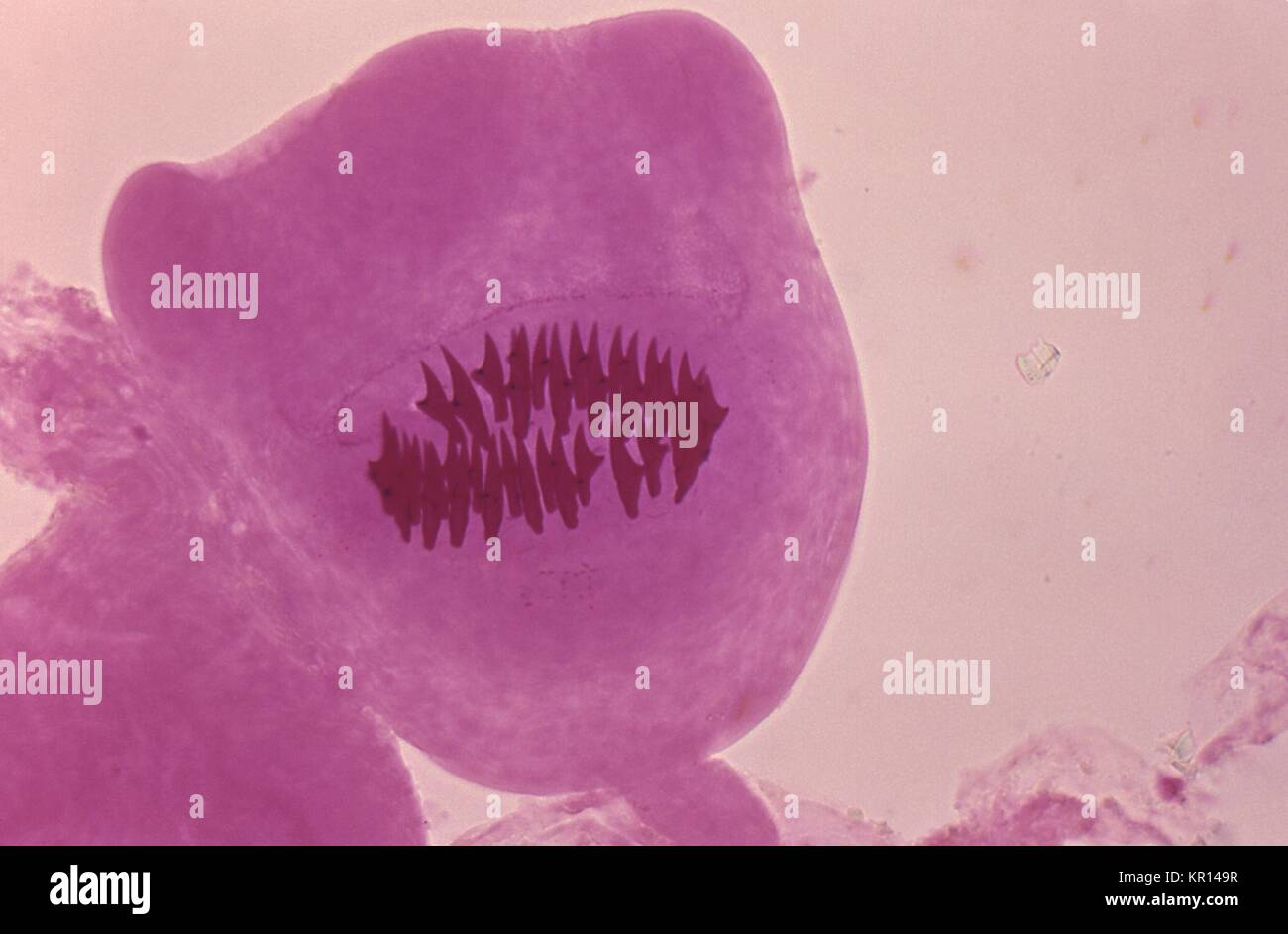 Echinococcus hi-res stock photography and images - Alamy