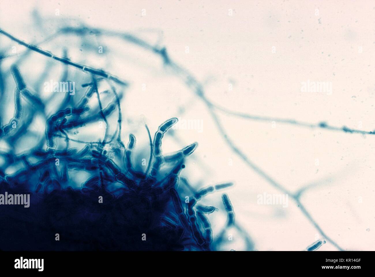 Fungi arthroderma incurvata hi-res stock photography and images - Alamy