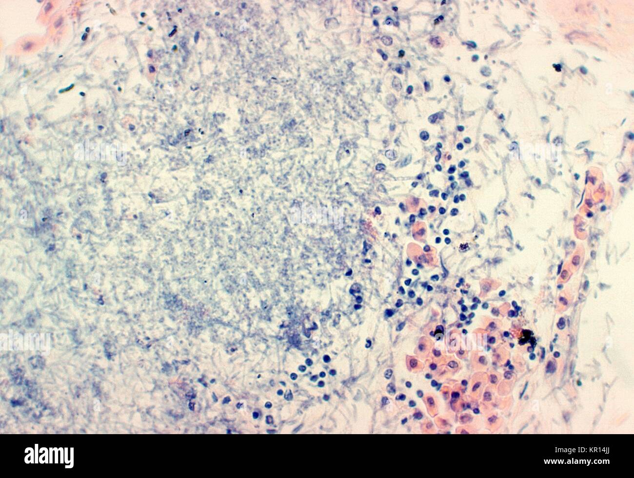 Histopathology of the lung of a box turtle experimentally infected with ...