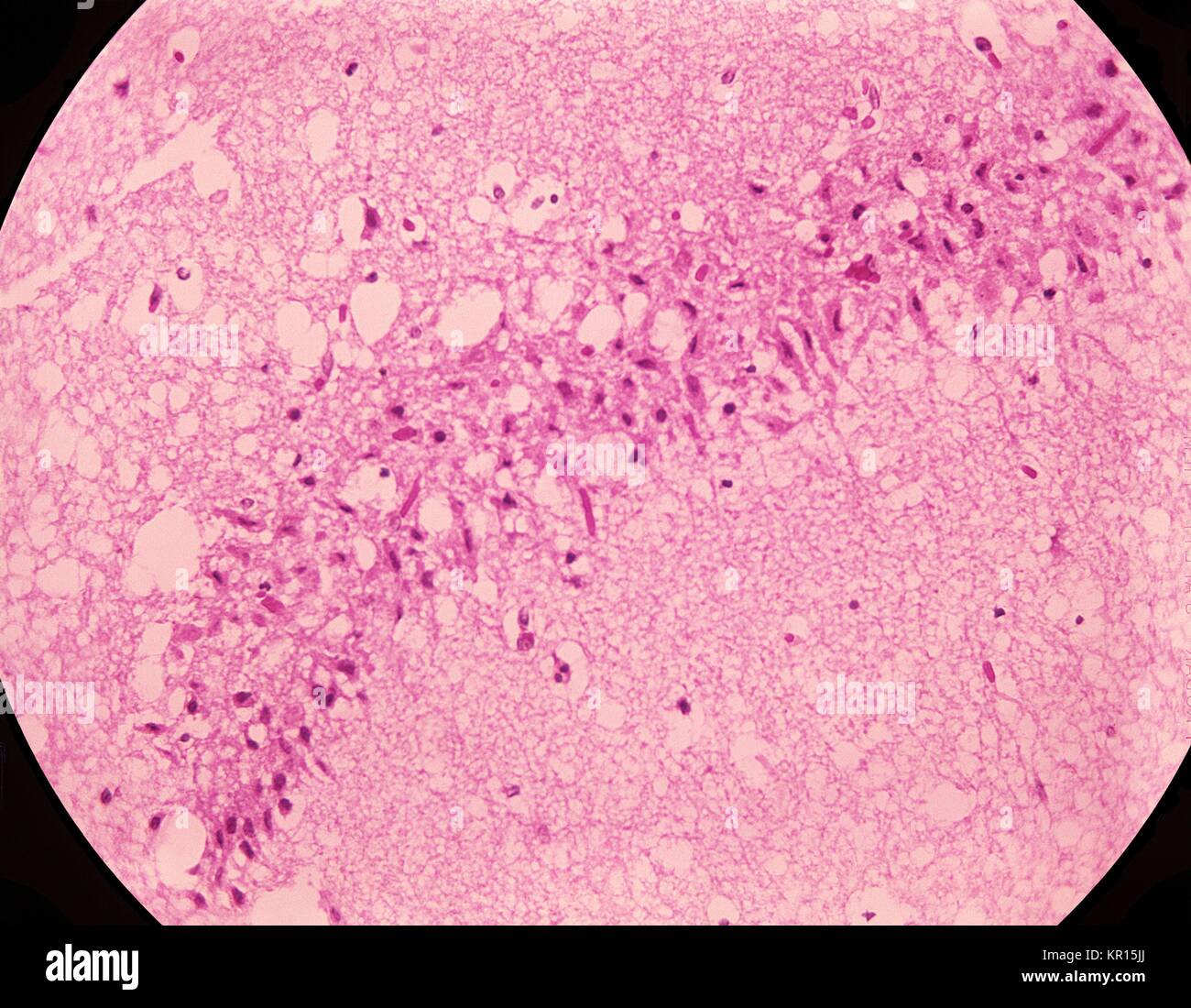 Nervous tissue mouse hi-res stock photography and images - Alamy