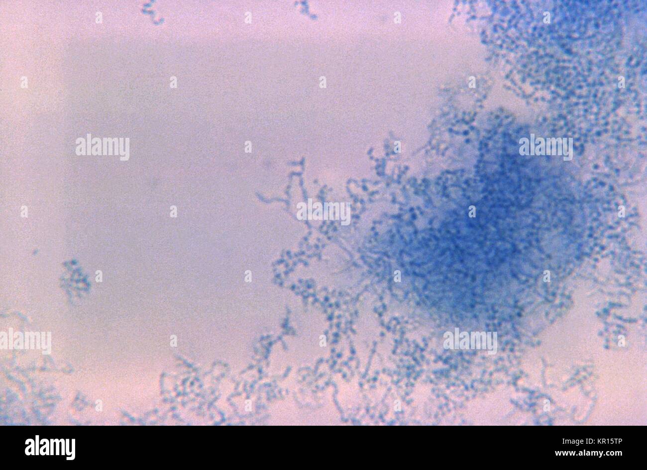 A photomicrograph of Nocardia asteroides grown in a laboratory culture ...